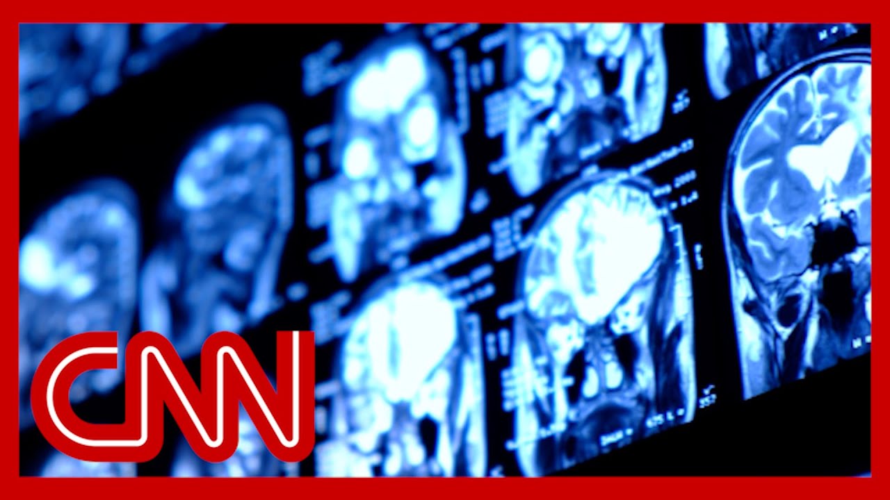 How the technology behind ChatGPT could make mind-reading a reality ...